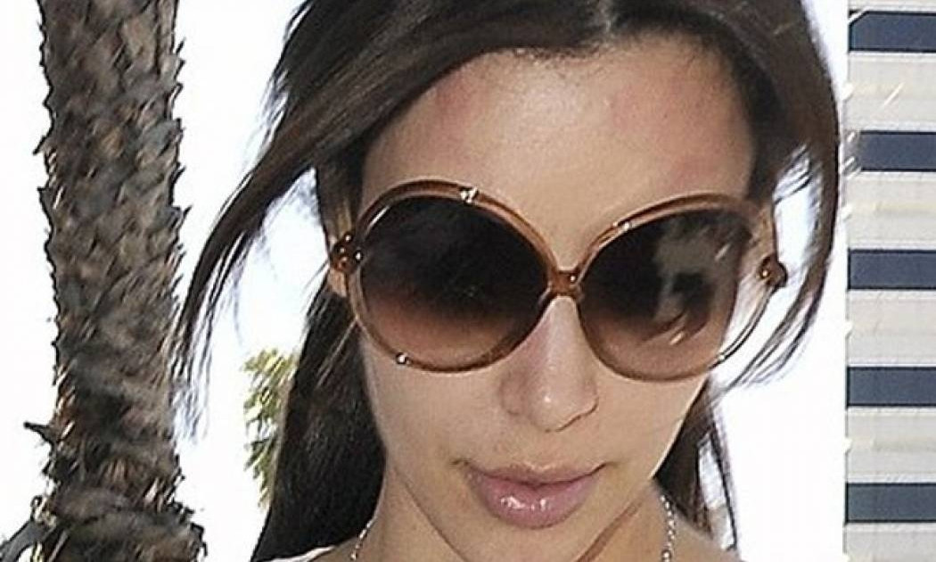 H Kim και το μυστικό botox της | Gossip-tv.gr