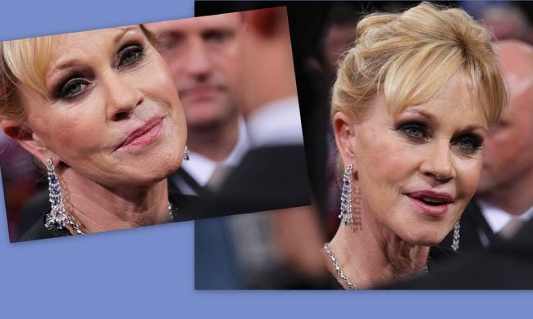 Το πρόσωπό της Melanie Griffith, που σοκάρει! | Gossip-tv.gr